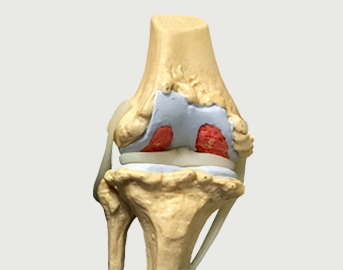 Home - Arthrosin