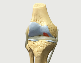 Home - Arthrosin