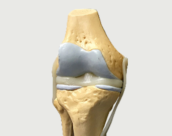 Home - Arthrosin